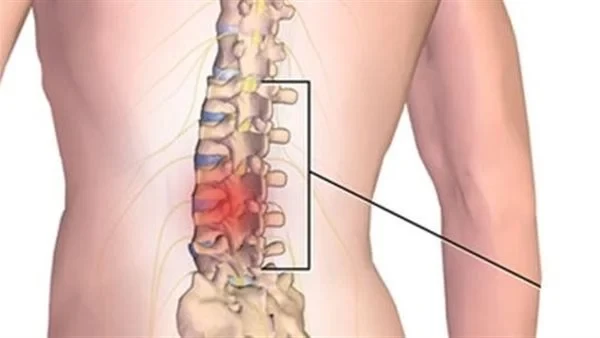 lumbar discectomy post-operative instructions
